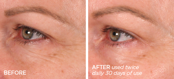 Quench Eye Balm | Reviving Quadralipid Eye Balm | Skin Firming Balm ...